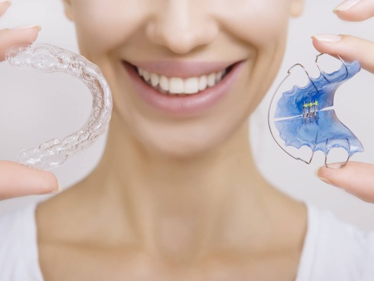 Aligners vs. Retainers: What’s the Difference? | PretoriaSmile