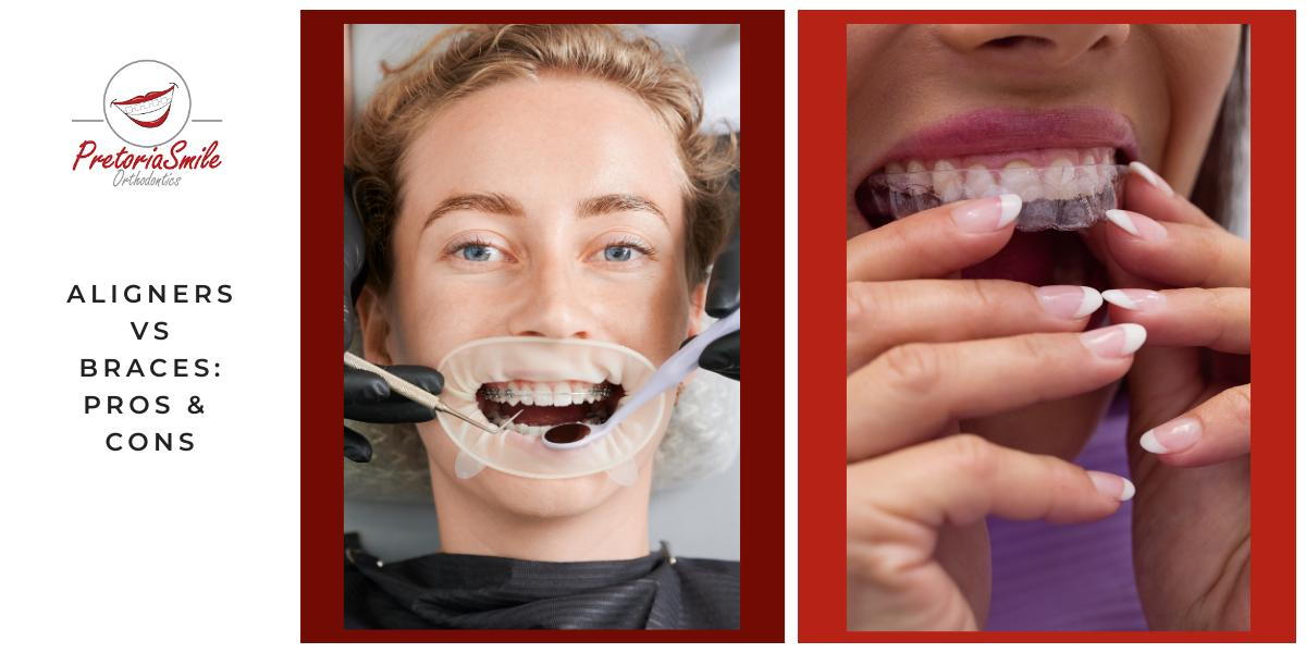 Clear Aligners vs Braces - PretoriaSmile Orthodontics